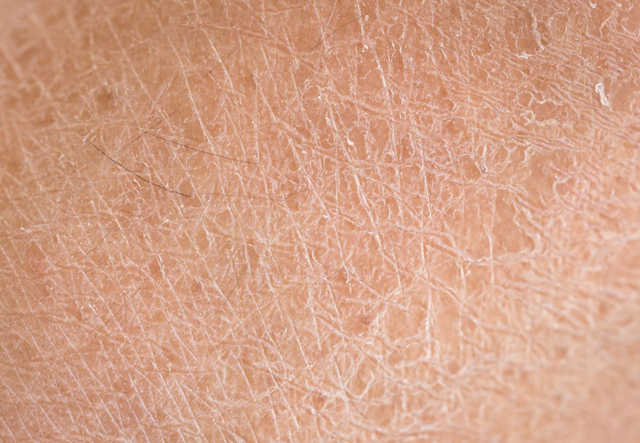 Tipos de piel, ¡identifica la tuya! - CIO Salud