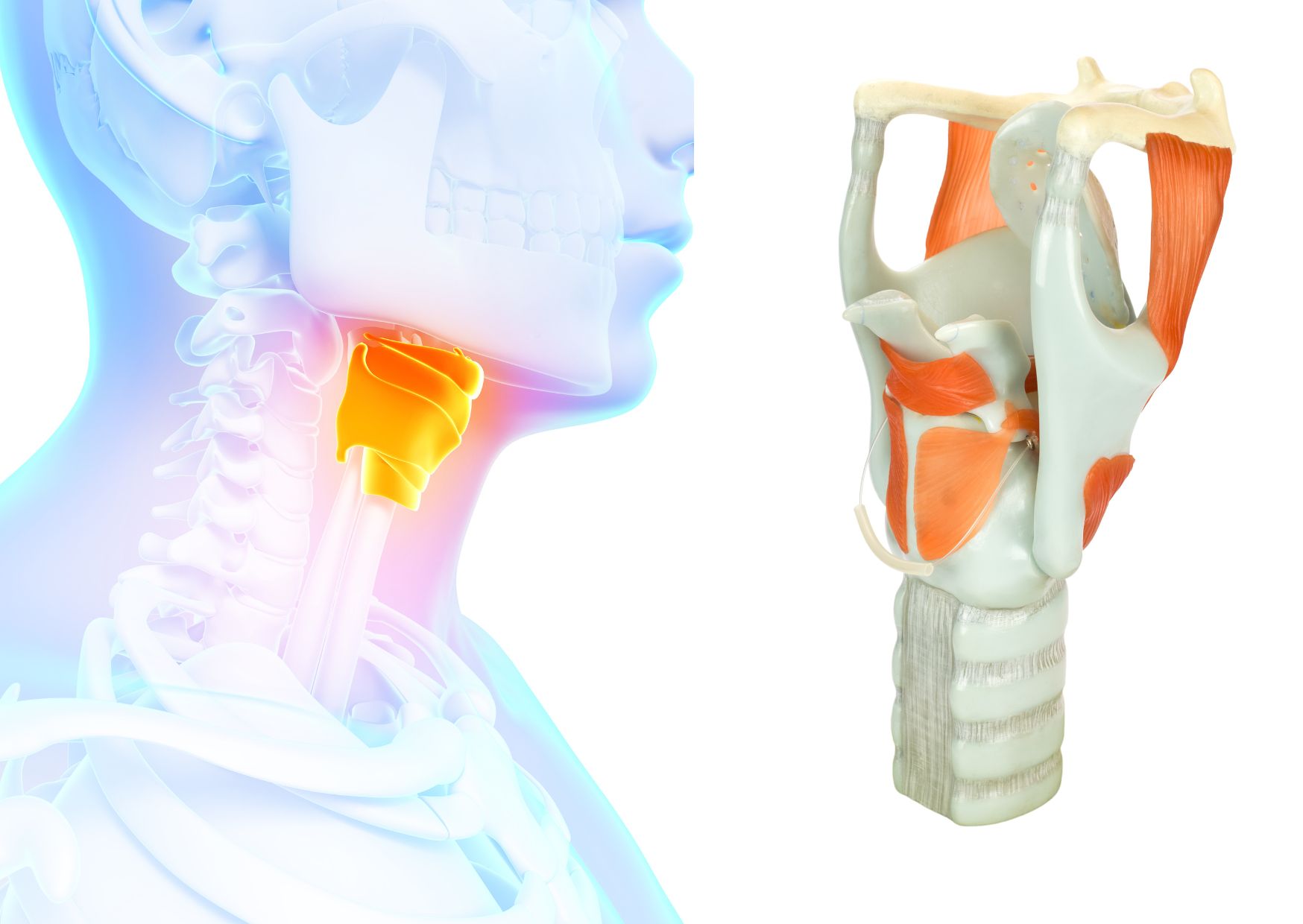 Laringectomía total: Procedimiento quirúrgico - CIO Salud
